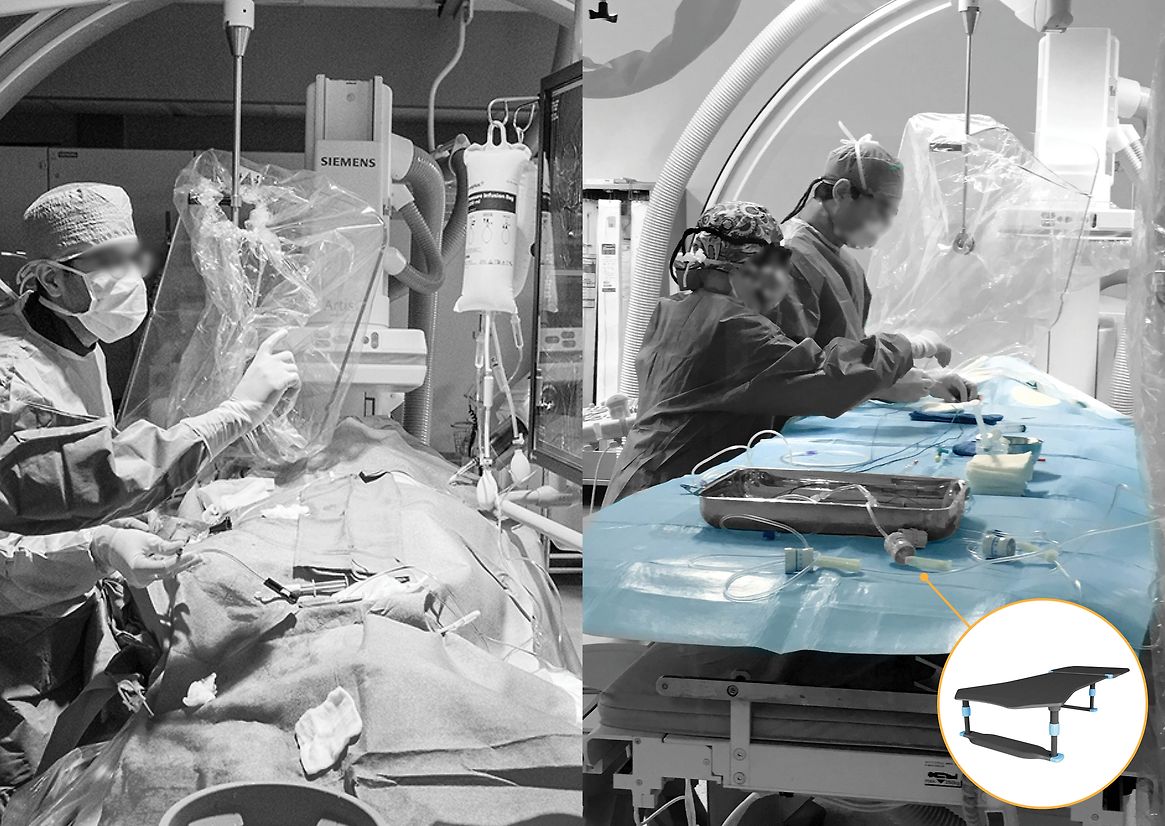 Developing a range of Medical Imaging Table Accessories from the ground up - A 10 year project ...